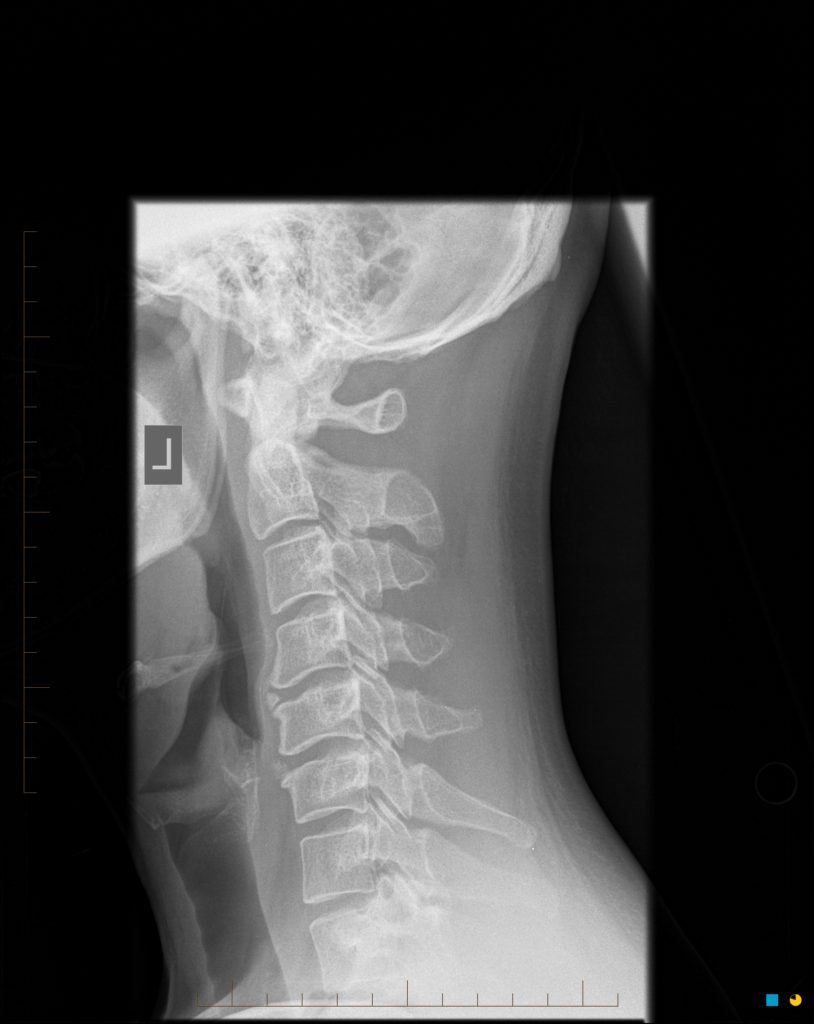 full-chiro-erect-series-inc-pelvis-0001 - Happy Chiropractic